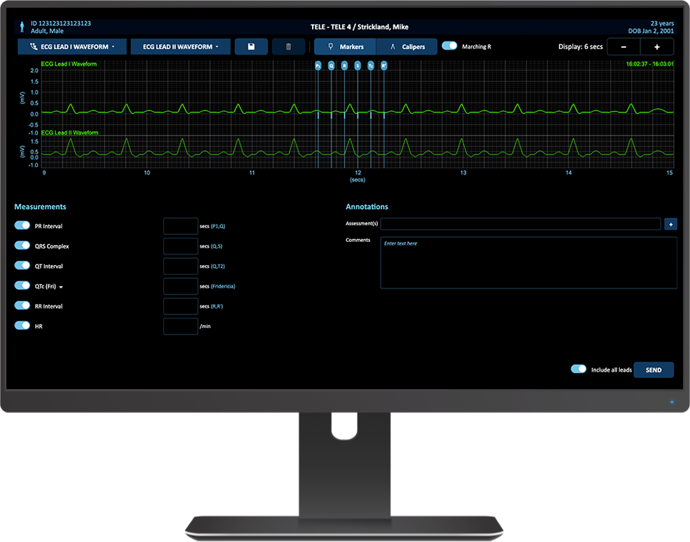 Capsule Clinical Surveillance - Ventilated Patient - Respiratory Depression