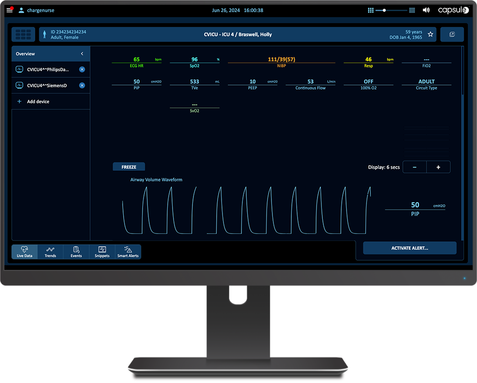 Capsule Clinical Surveillance - Ventilated Patient - Respiratory Depression